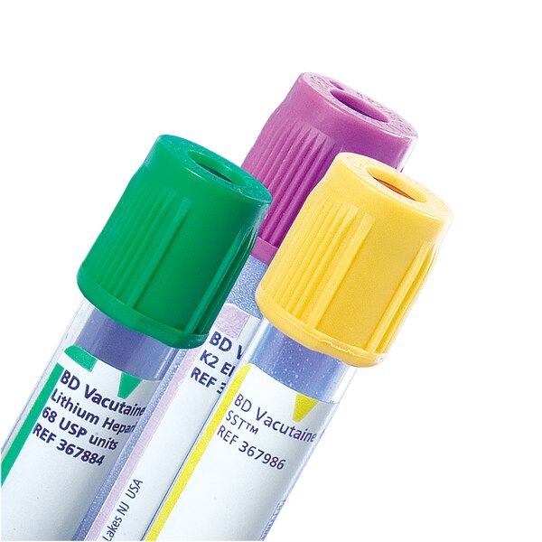 BD Vacutainer® Plus Venous Blood Collection Tube, Sodium Fluoride/Na2 ...