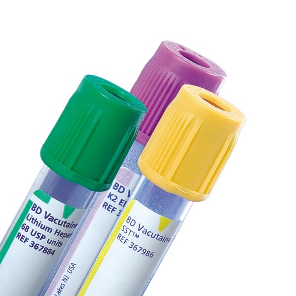 BD Vacutainer® Plus SST™ Venous Blood Collection Tube, Clot Activator ...